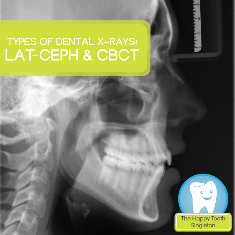 Types of dental x-rays – Lat-Ceph & CBCT | The Happy Tooth Singleton